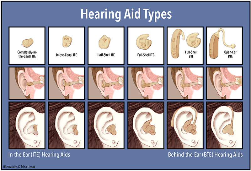 How to Select the Right Hearing Aid - Puget Sound Consumers' Checkbook
