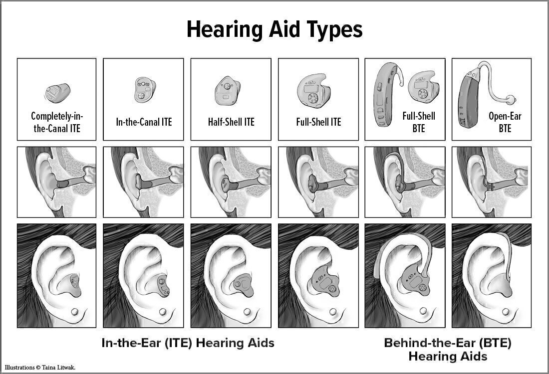Hearing Aid Styles In Ear at Layla Swallow blog